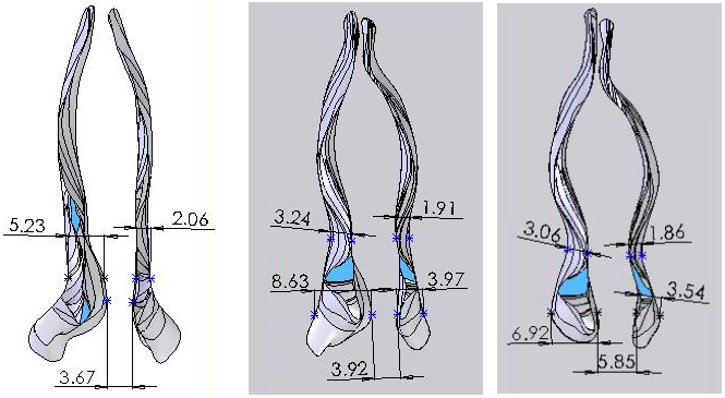 The Importance of the Nasal Valve and Inferior Turbinate heads - Empty ...