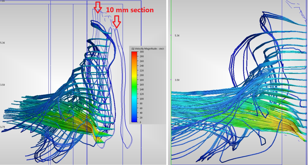 The Importance of the Nasal Valve and Inferior Turbinate heads - Empty ...